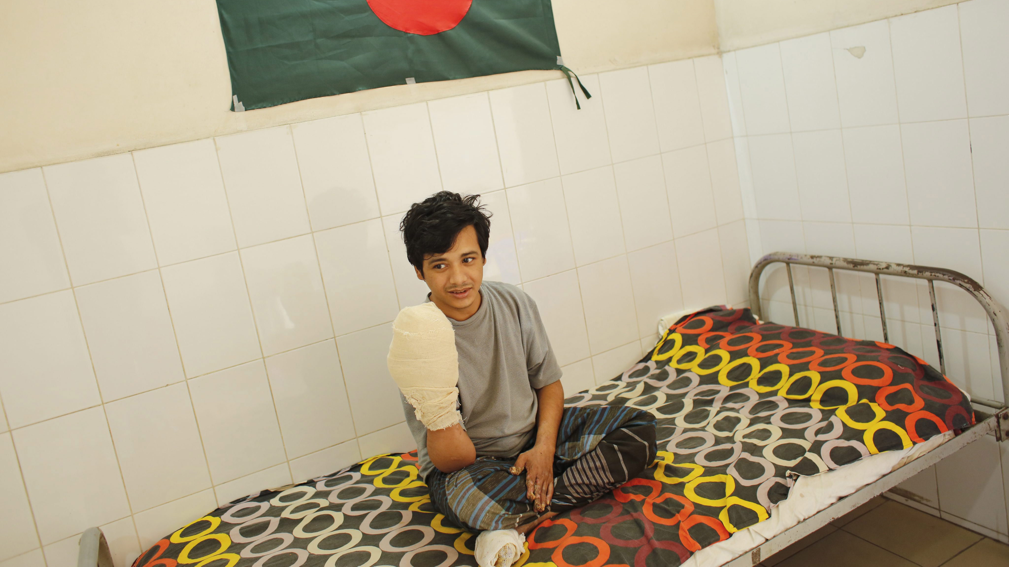 Tree Man Disease Cured